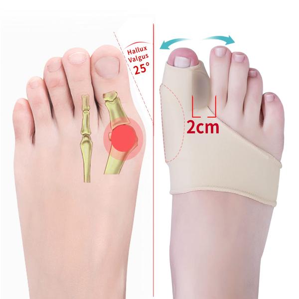 商品名:  JANMISI Bunion Corrector, Orthopedic Bunion Splint for Men and Women, Big Toe Hallux Valgus Hammer Toe Straightene...