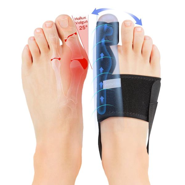商品名:  Potensgo Bunion Corrector for Women and Men 2pcs Upgraded, Premium Orthopedic Big Toe Straightener for Bunion Reli...