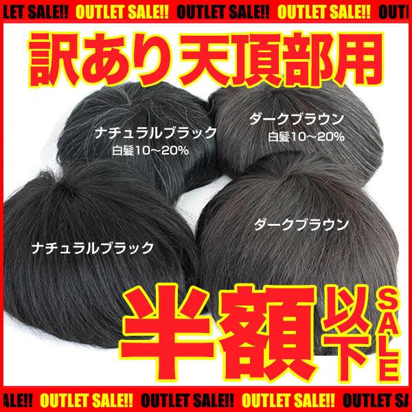ヘアーインプラントEX天頂部用の訳ありアウトレット品!!今回は在庫処分として特別価格にて大放出させていただきます。※こちらの商品には備品が付属していません。※在庫に限りがございますのでご了承ください。※2枚以上の購入で更に割引!※訳あり奉仕...