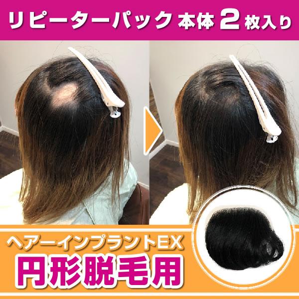 １枚あたり23,200円ととってもお得！※通常版(25,300円)【パッケージ内容】ヘアーインプラント本体(円形脱毛用2枚)★初めてヘアーインプラントEXシリーズをご購入される方は付属品が充実した通常版を御求め下さい。