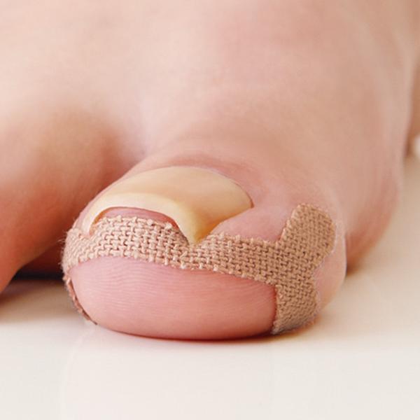 サイズ/約横5.5×縦2cm内容量/40枚入り（1シート：4枚）材質/綿、ポリウレタン生産国/日本製●巻き爪をやさしくサポートするフットケアテープです。●爪が食い込んでいる部分にテープを差し込み、押し下げながら貼ることで皮膚を爪の食い込みか...