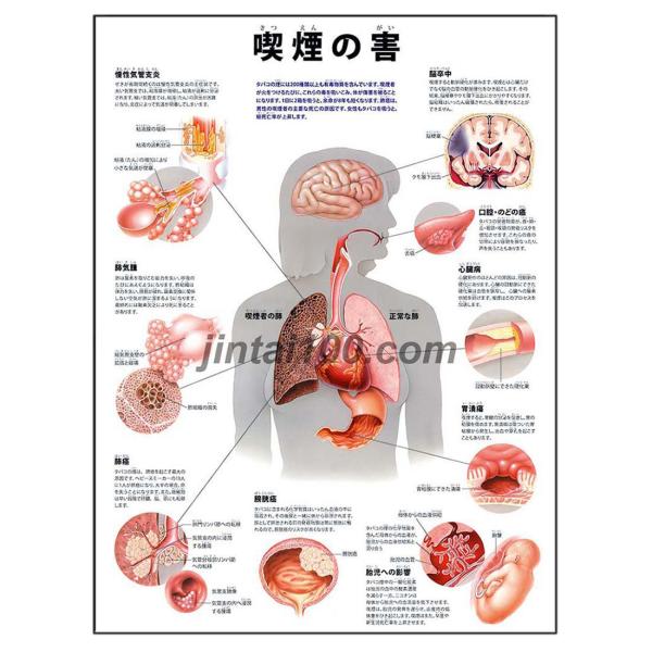 ポスター『喫煙の害』主要内容：・ 喫煙に影響される臓器・ 口腔、のどの癌・ 慢性気管支炎・ 肺気腫・ 肺癌・ 膀胱癌・ 脳卒中・ 心臓病・ 胃潰瘍・ 胎児への影響タバコの煙には200種類以上もの有毒物質を含んでおり、喫煙者は日々毒物を体内に...