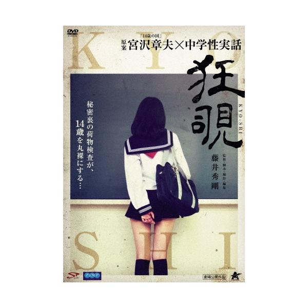 ◆品　番：ALBSD-2160◆発売日：2017年11月02日発売◆出荷目安：２〜５日◆キョウシ