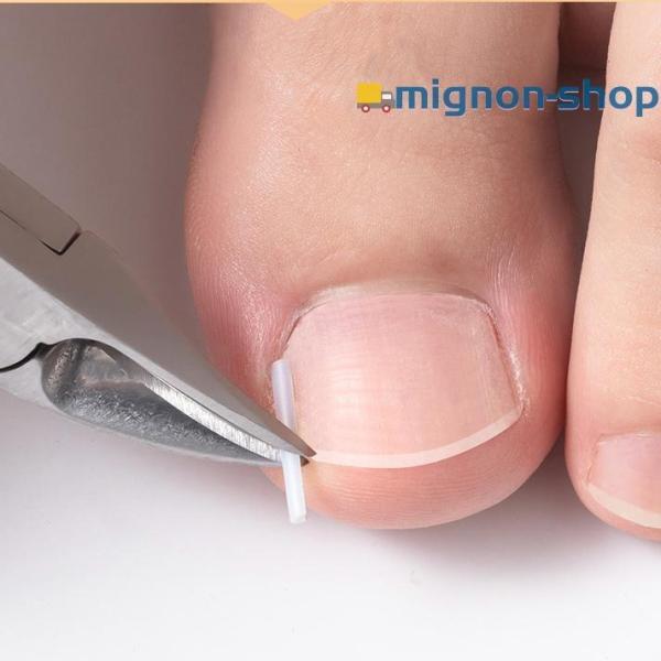 送料無料 巻き爪ケア 足 爪 ケア 巻爪 巻き爪ガード 60本セット やわらか クッション 痛み軽減 巻き爪グッズ 簡単 お手軽 ギフト