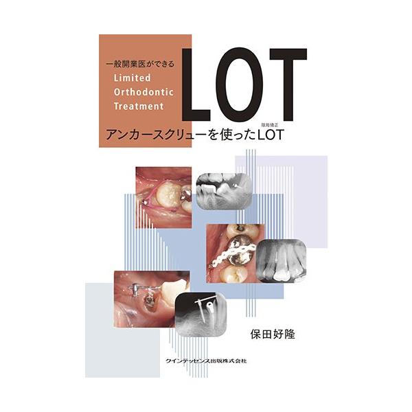 ※掲載されている商品の写真は代表写真となっておりますので、外箱、説明書、リモコン等は付属しない場合がございます。用途機能として最低限の付属品はお送りいたしますが、気になる方はご購入前にお問い合わせをお願いいたします。またイヤホン・カートリッ...