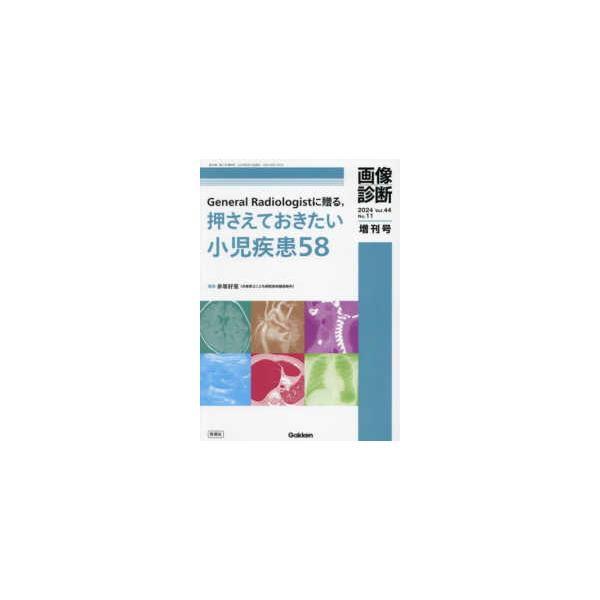 【発売日：2024年09月01日】著者：赤坂好宣出版社：Ｇａｋｋｅｎ