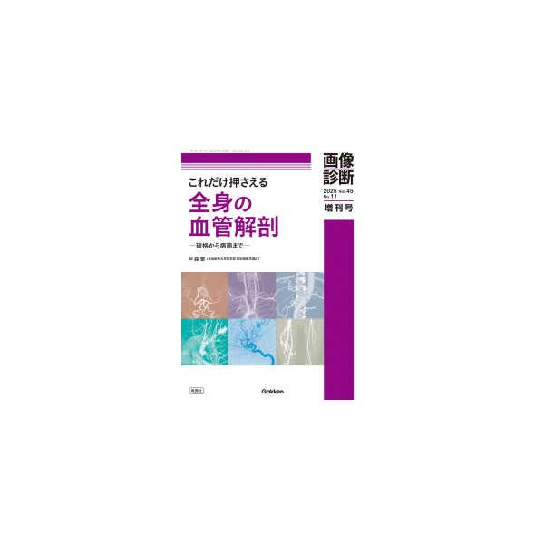【発売日：2025年08月30日】著者：森墾出版社：Ｇａｋｋｅｎ