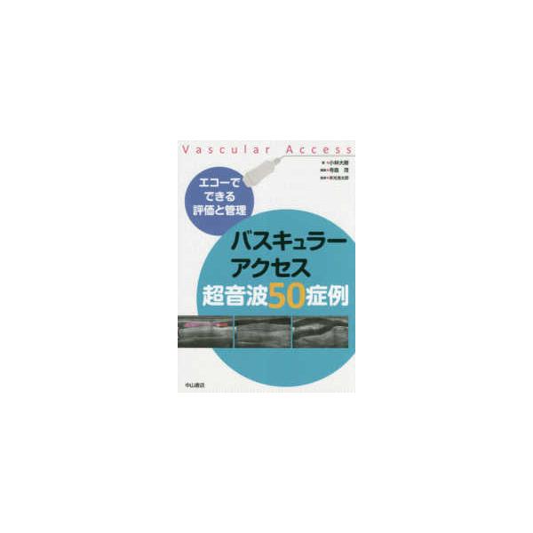 【発売日：2019年06月01日】著者：末光 浩太郎【監修】/寺島 茂【編】/小林 大樹【著】出版社：中山書店