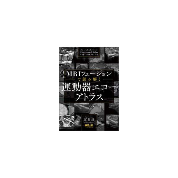【発売日：2026年06月01日】著者：面谷 透【著】出版社：羊土社