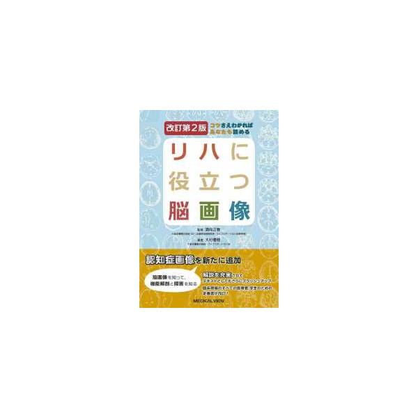 【発売日：2020年10月01日】著者：酒向正春/大村優慈出版社：メジカルビュー社