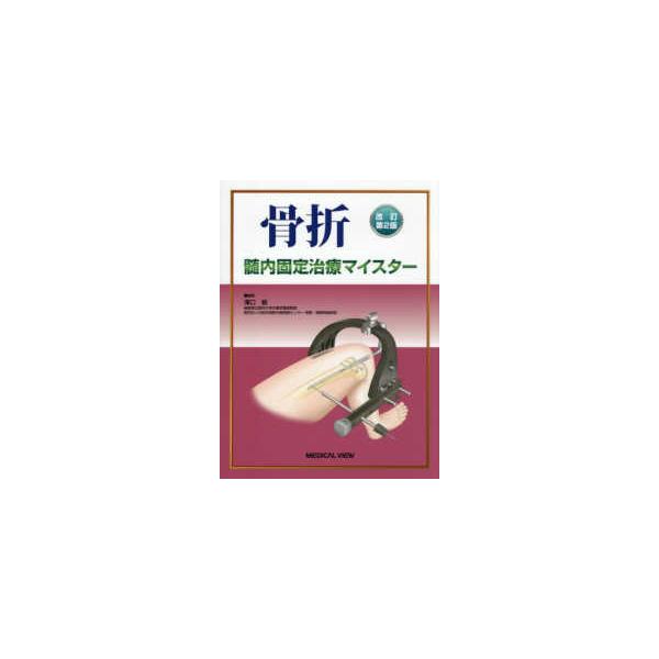 【発売日：2026年06月01日】著者：澤口 毅【編集】出版社：メジカルビュー社