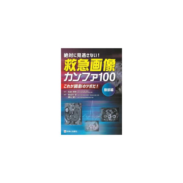 【発売日：2026年01月01日】著者：松田剛明/長谷川浩出版社：診断と治療社