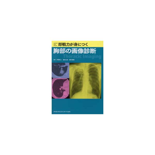 【発売日：2024年04月01日】著者：芦澤和人/藤本公則出版社：メディカル・サイエンス・インターナショナ