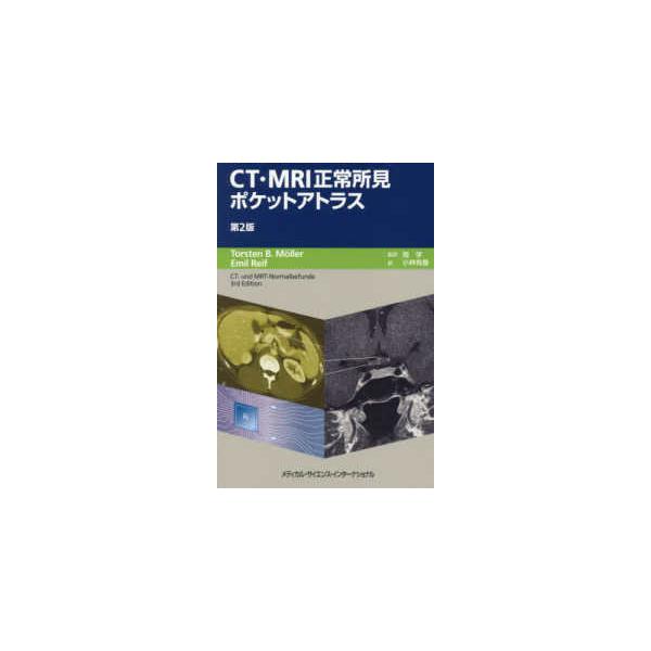 【発売日：2025年09月01日】著者：トルステン・Ｂ．メーラー/エミール・レイフ出版社：メディカル・サイエンス・インターナショナ