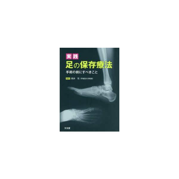 【発売日：2023年02月01日】著者：熊井 司【編】出版社：文光堂