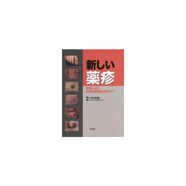 【発売日：2019年11月01日】著者：戸倉 新樹【編】出版社：文光堂