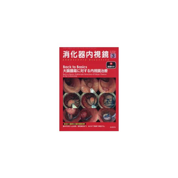 【発売日：2026年04月01日】著者：消化器内視鏡編集委員会出版社：東京医学社