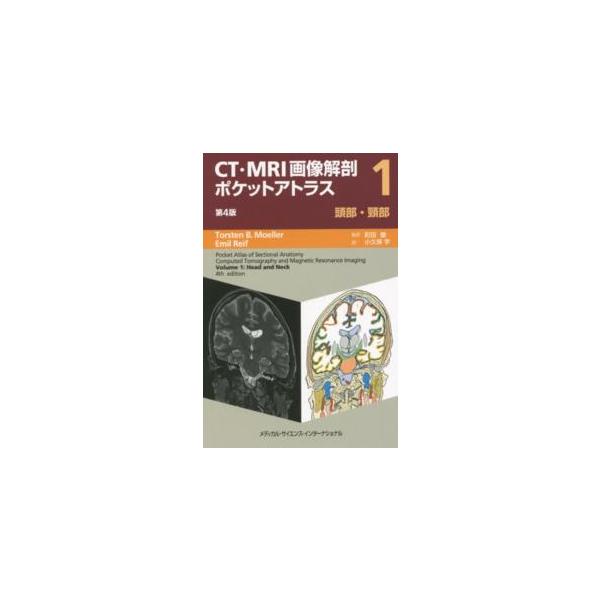 【発売日：2015年01月01日】著者：メーラー，トルステン・Ｂ．〈Ｍｏｅｌｌｅｒ，Ｔｏｒｓｔｅｎ　Ｂ．〉/レイフ，エミール【著】〈Ｒｅｉｆ，Ｅｍｉｌ〉/町田 徹【監訳】/小久保 宇【訳】出版社：メディカル・サイエンス・インターナショナ