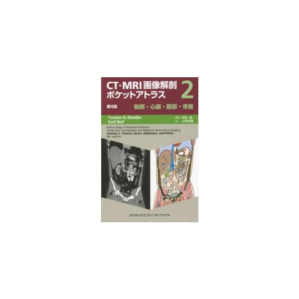【発売日：2015年01月01日】著者：メーラー，トルステン・Ｂ．〈Ｍｏｅｌｌｅｒ，Ｔｏｒｓｔｅｎ　Ｂ．〉/レイフ，エミール【著】〈Ｒｅｉｆ，Ｅｍｉｌ〉/町田 徹【監訳】/小林 有香【訳】出版社：メディカル・サイエンス・インターナショナ