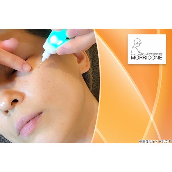 【発売日：2026年04月26日】[店舗名]Skin salon de MORRICONE[所在地]〒108-0071 東京都港区白金台3-14-35白金台ドルチェ４F（オートロックのため４０１と呼び出してください） [ＴＥＬ]036450...