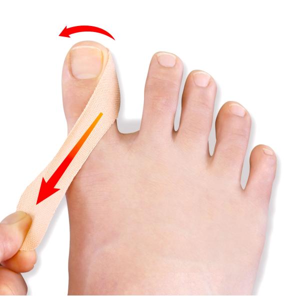 貼るだけでツラい親指がラクに！フットケア専門に開発されたテープを貼るだけ。曲がった親指をテープでグイッと引っ張りピタリとまっすぐクセづけします。付け根も摩擦からガードしながら靴も履けます。衛生的な使い捨てタイプです。