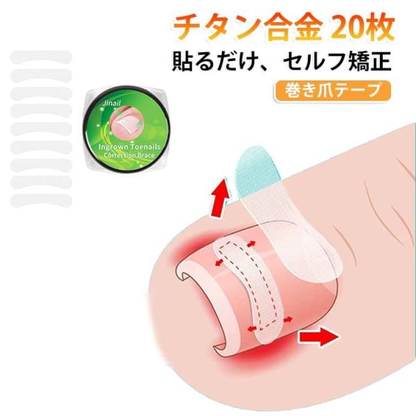商品名:シール 目立ちにくい 20枚入り 巻爪 矯正器具 矯正テープ 巻き爪テープ 矯正 貼るだけ 痛み 足爪 足指 巻き爪対策 テープ リフトアップ 巻き爪 貼るだけ 痛み軽減                            商品説...