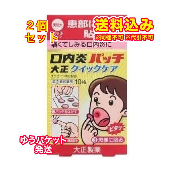 貼る口内炎治療薬です。口腔内ですぐれた付着力をもち、患部を刺激からしっかりカバーし、また、成分が持続的に作用します。