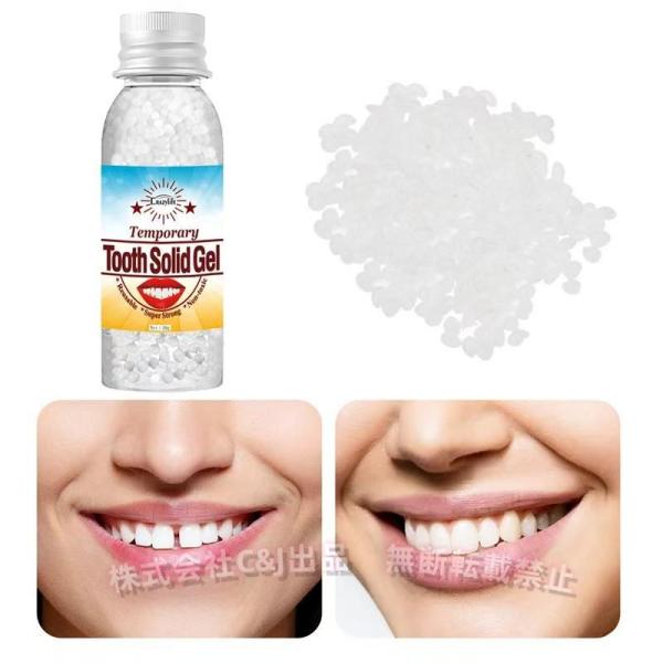 フィッティングビーズ、超便利、簡単操作。様々な形の歯を作ることができます。