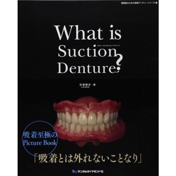 What is Suction Denture? (開業医のための実践デンチャーシリーズ 4)