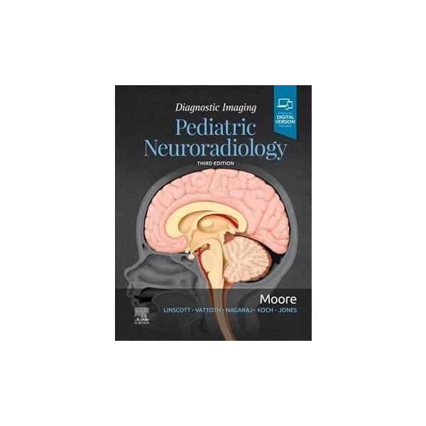 【お取り寄せ・キャンセル不可の商品】：2週間~4週間でお届け（お急ぎの方はご遠慮ください。）　／　【本の説明】1096ページ　216*276mm　言語：English　国：アメリカ　1389g　ISBN：9780323680318　／　【本...