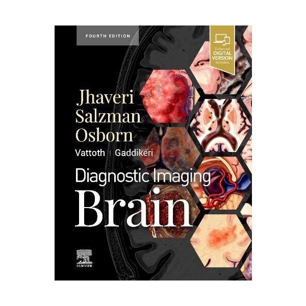 【お取り寄せ・キャンセル不可の商品】：2週間~4週間でお届け（お急ぎの方はご遠慮ください。）　／　【本の説明】1300ページ　216*276mm　言語：English　国：アメリカ　1622g　ISBN：9780323756204　／　【本...