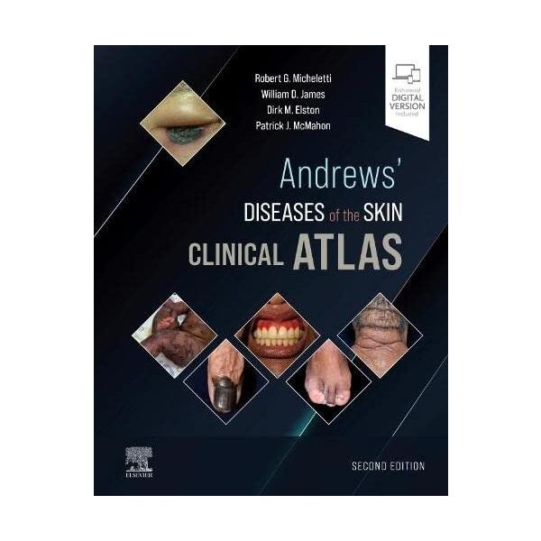 【お取り寄せ・キャンセル不可の商品】：2週間~4週間でお届け（お急ぎの方はご遠慮ください。）　／　【本の説明】616ページ　216*276mm　言語：English　国：アメリカ　1950g　ISBN：9780323790130　／　【本の...