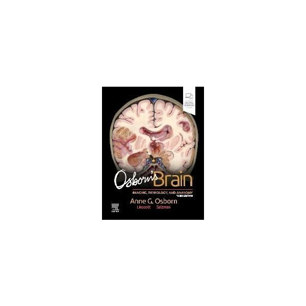 【お取り寄せ・キャンセル不可の商品】：2週間~4週間でお届け（お急ぎの方はご遠慮ください。）　／　【本の説明】1400ページ　215*276mm　言語：English　国：イギリス　2920g　ISBN：9780443109379　／　【本...