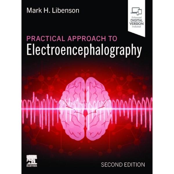 【お取り寄せ・キャンセル不可の商品】：2週間~4週間でお届け（お急ぎの方はご遠慮ください。）　／　【本の説明】218*282mm　言語：English　560g　ISBN：9780443348365　／　【本の内容】Using a  hig...