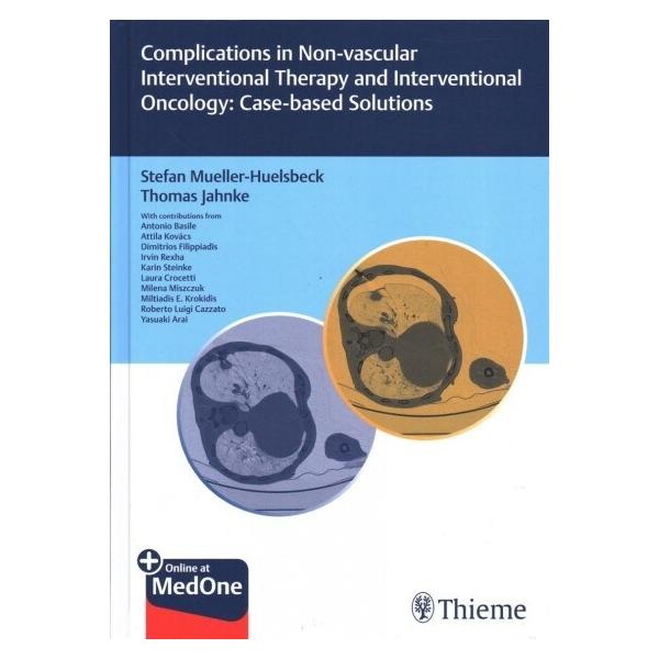 【お取り寄せ・キャンセル不可の商品】：2週間~4週間でお届け（お急ぎの方はご遠慮ください。）　／　【本の説明】150ページ　175*244mm　言語：English　国：ドイツ　522g　ISBN：9783132412873　／　【本の内容...