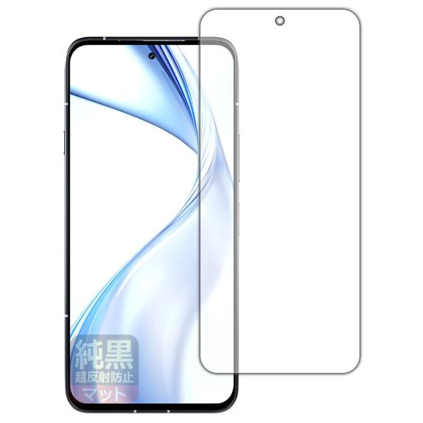 【商品概要】対応機種 : FCNT arrows Alpha (docomo F-51F / 楽天モバイル M08 / SIMフリー M08)専用の商品です。 (アローズ アルファ)製品内容 : 画面用フィルム1枚・クリーニングワイプ1個※...