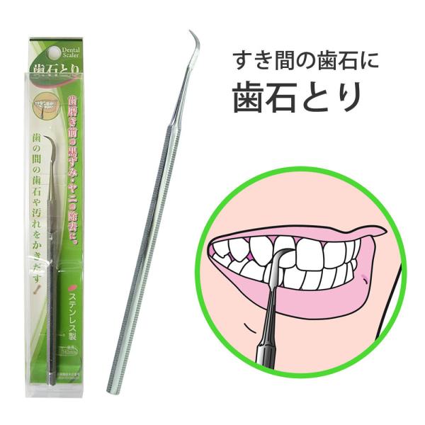 歯石とり ◆ デンタルケア 一般医療機器 歯垢とり 歯の表面 オーラルケア 虫歯予防 口内ケア 口内クリーニング 歯科 歯医者さんが使う爆買