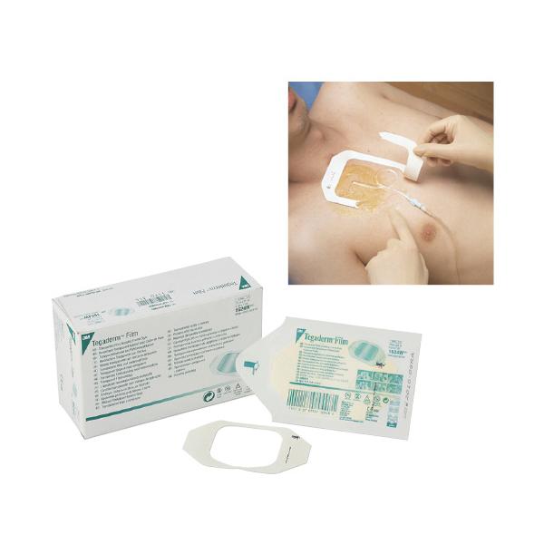 特徴フィルムは水蒸気・酸素の透過性に優れ、水やバクテリアの侵入を防ぎます。はがさずに貼付したまま、フィルムを通して部位を観察できます。カテーテル穿刺部・創傷の被覆・保護等に適しています。仕様γ線滅菌済（個包装）フレームタイプサイズ（mm）：...