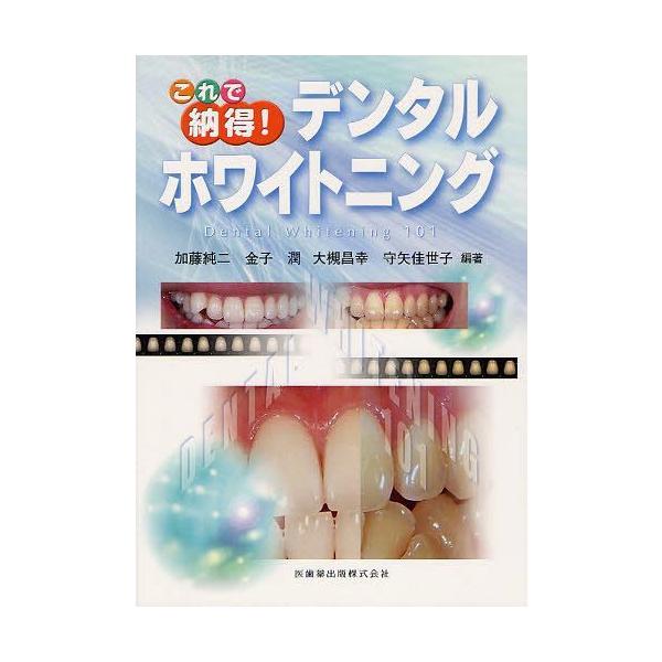 【発売日：2012年07月28日】加藤純二/編著 金子潤/編著 大槻昌幸/編著 守矢佳世子/編著/これで納得!デンタルホワイトニング Dental Whitening 101、メディア：BOOK、発売日：2012/07、重量：340g、商品...