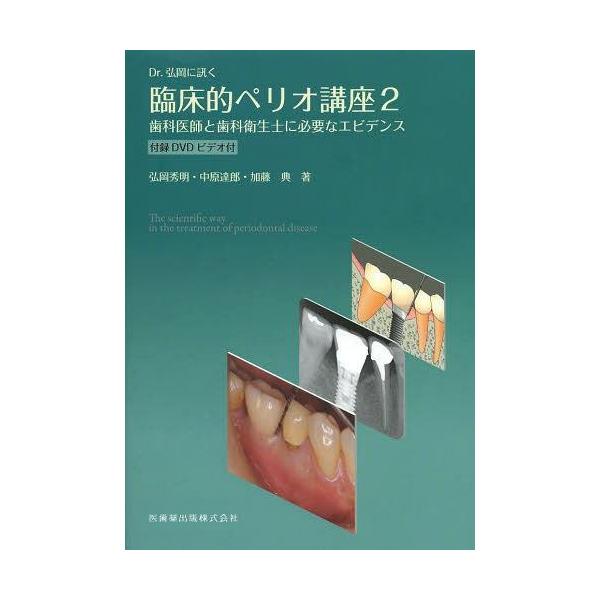 【発売日：2013年07月23日】弘岡秀明/著 中原達郎/著 加藤典/著/Dr.弘岡に訊く臨床的ペリオ講座 2、メディア：BOOK、発売日：2013/07、重量：340g、商品コード：NEOBK-1533974、JANコード/ISBNコード...