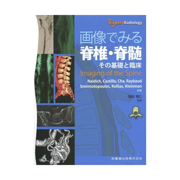 【発売日：2013年09月16日】ThomasP.Naidich/ほか原著 塩田悦仁/監訳/画像でみる脊椎・脊髄 その基礎と臨床 Expert Radiology / 原タイトル:IMAGING OF THE SPINE、メディア：BOOK...
