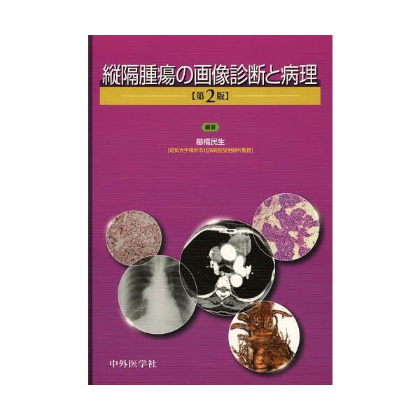 【発売日：2014年04月21日】櫛橋民生/編著/縦隔腫瘍の画像診断と病理、メディア：BOOK、発売日：2014/04、重量：340g、商品コード：NEOBK-1656285、JANコード/ISBNコード：9784498031937
