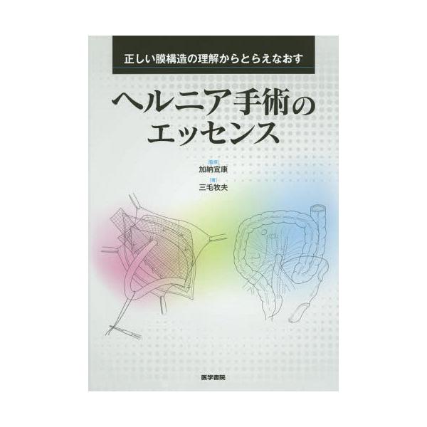 【発売日：2014年06月30日】加納宣康/監修 三毛牧夫/著/ヘルニア手術のエッセンス 正しい膜構造の理解からとらえなおす、メディア：BOOK、発売日：2014/06、重量：340g、商品コード：NEOBK-1683633、JANコード/...