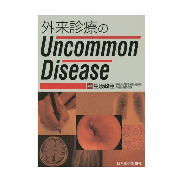 【発売日：2014年09月11日】生坂政臣/編著/外来診療のUncommon Disease、メディア：BOOK、発売日：2014/09、重量：412g、商品コード：NEOBK-1709469、JANコード/ISBNコード：97847849...