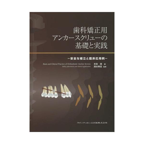 【発売日：2014年10月27日】本吉満/著 清水典佳/監修/歯科矯正用アンカースクリューの基礎と実践 安全な植立と臨床応用例、メディア：BOOK、発売日：2014/10、重量：736g、商品コード：NEOBK-1724798、JANコード...