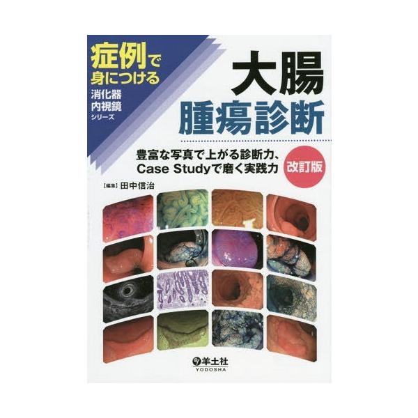 【発売日：2014年10月27日】田中信治/編集/大腸腫瘍診断 豊富な写真で上がる診断力、Case Studyで磨く実践力 (症例で身につける消化器内視鏡シリーズ)、メディア：BOOK、発売日：2014/10、重量：340g、商品コード：N...