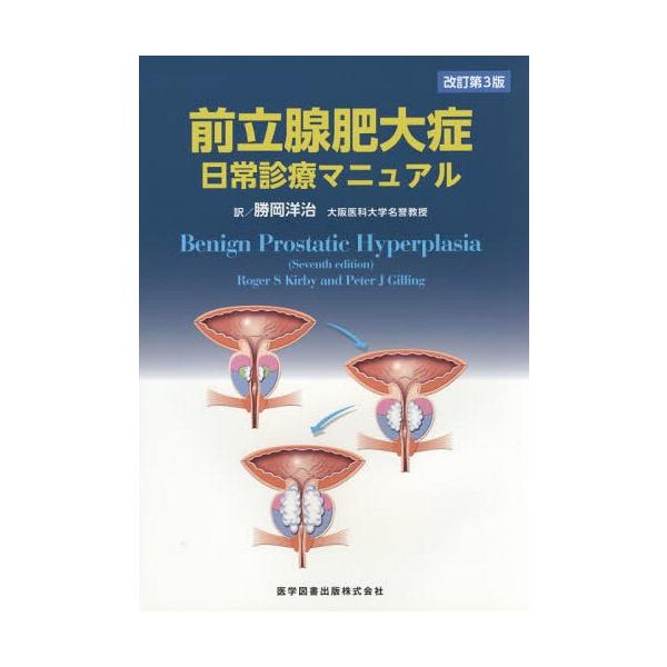 【発売日：2014年10月28日】勝岡洋治/訳 RogerSKirby/〔著〕 PeterJGilling/〔著〕/前立腺肥大症日常診療マニュアル / 原タイトル:Benign Prostatic Hyperplasia 原著第7版の翻訳、...