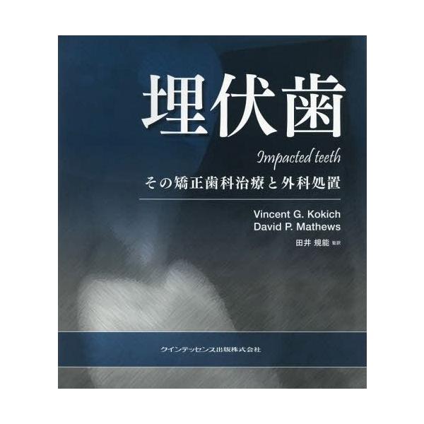 【発売日：2015年02月11日】VincentG.Kokich/著 DavidP.Mathews/著 田井規能/監訳/埋伏歯 その矯正歯科治療と外科処置 / 原タイトル:Impacted teeth、メディア：BOOK、発売日：2015/...