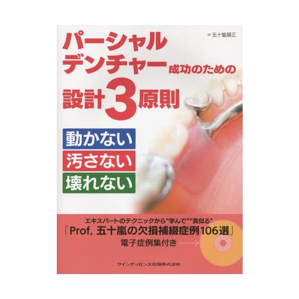 【発売日：2015年02月26日】五十嵐順正/著/パーシャルデンチャー成功のための設計3原則 動かない汚さない壊れない、メディア：BOOK、発売日：2015/02、重量：340g、商品コード：NEOBK-1772285、JANコード/ISB...