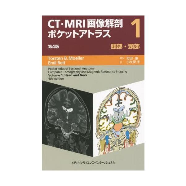 【発売日：2015年01月28日】トルステンB.メーラー/著 エミールレイフ/著 町田徹/監訳/CT・MRI画像解剖ポケットアトラス 1 / 原タイトル:Pocket Atlas of Sectional Anatomy.Volume1:H...
